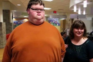 Adolescente pesaba más de 300 kg considerado el mas gordo del mundo y ...